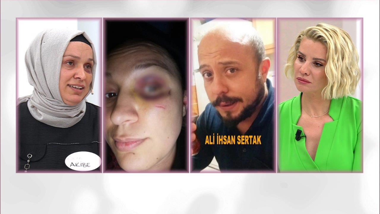 Esra Erolda Kocam Beni öldüresiye Dövdü